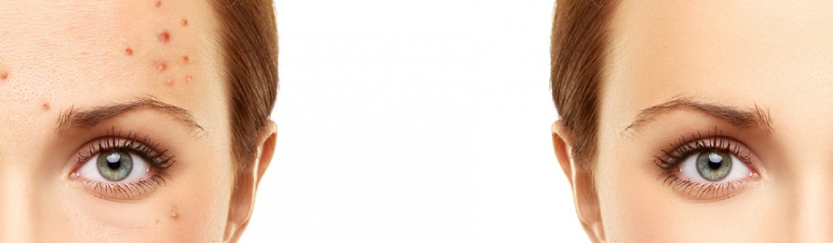 Préparations naturelles BIO contre les problèmes de peaux